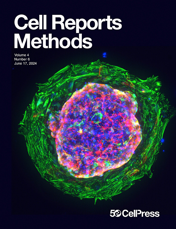 Recapitulating the Tumor Microenvironment in a Dish, One Cell Type at a ...
